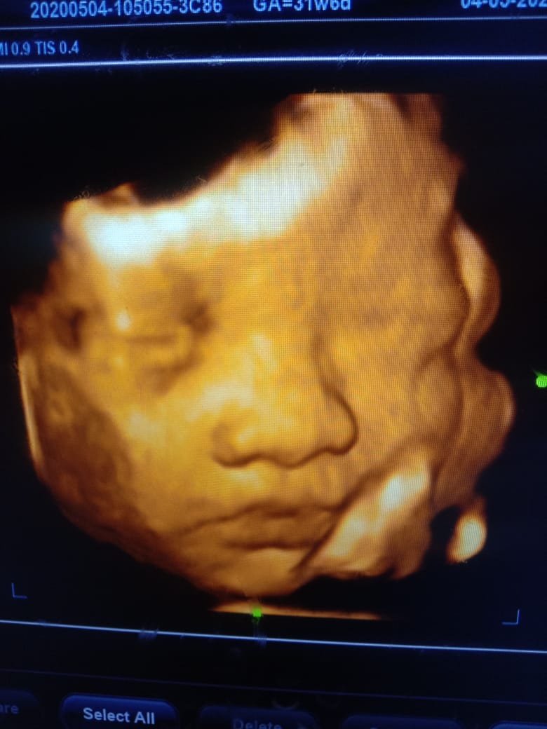 Scan baby 2D,3D,5D and detail scan near Bangi | Klinik Dr Engku